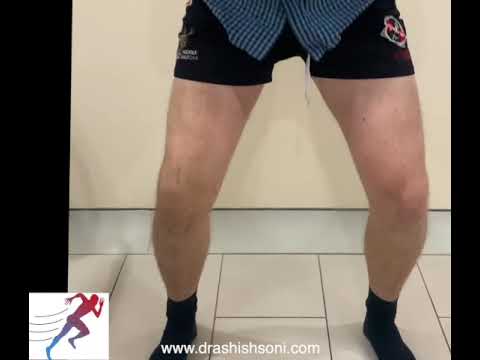 Quadriceps tendon ACL reconstruction - YouTube
