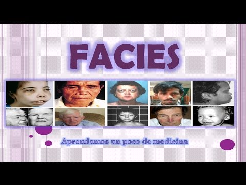 Tabela De Tipos De Pelos Faciais