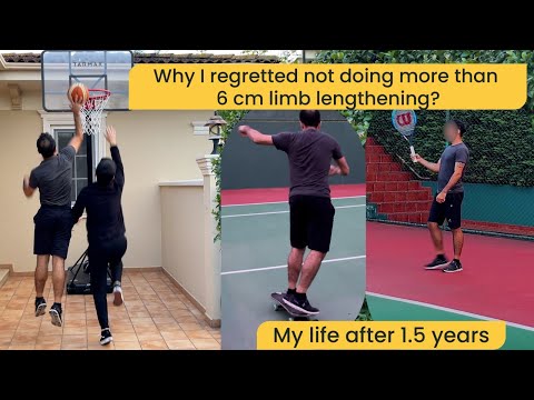 Why I regretted not doing more than +6 cm limb lengthening? / My Life After 1,5 years