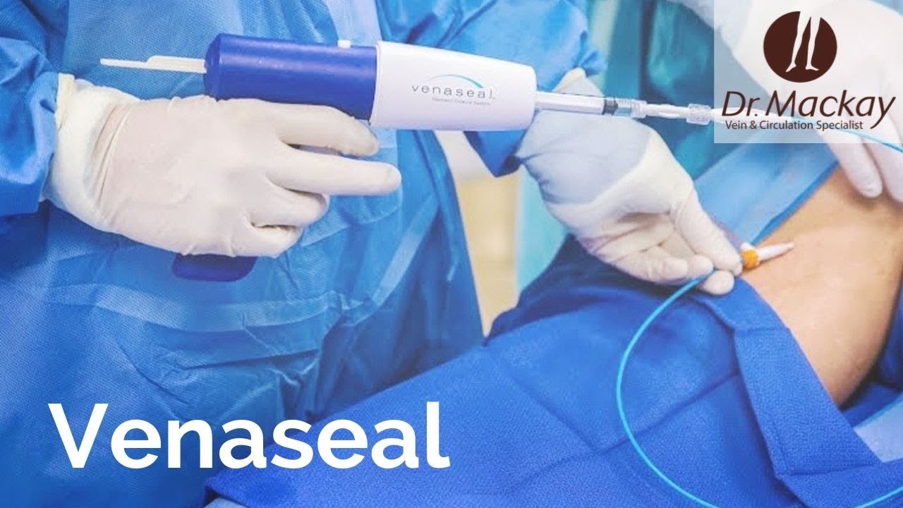 What is VenaSeal? - YouTube