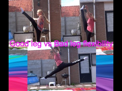 Good leg vs Bad leg flexibility - YouTube