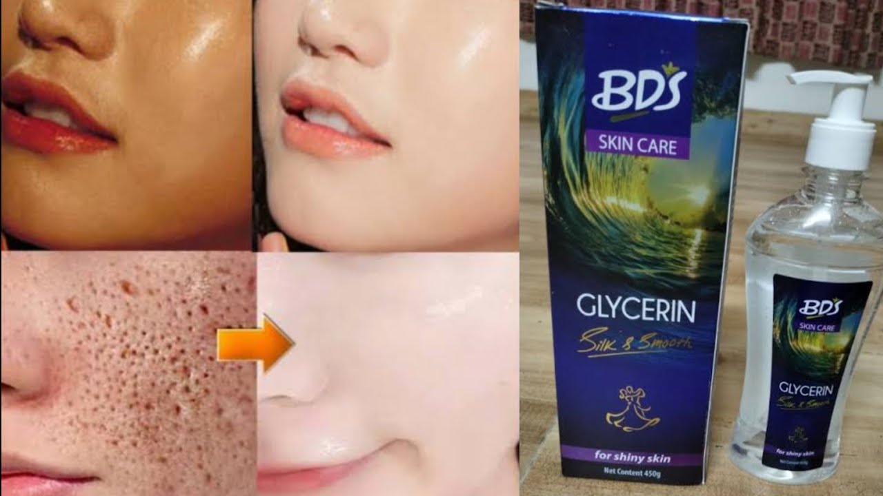 BDS Skin care Glycerine review+Demo.How to use Glycerine.Side effects ...