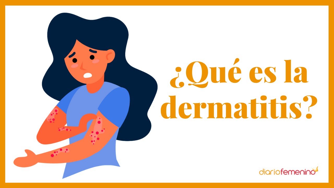 ¿Qué es la dermatitis? Tipos, causas, síntomas y cuidados de la ...