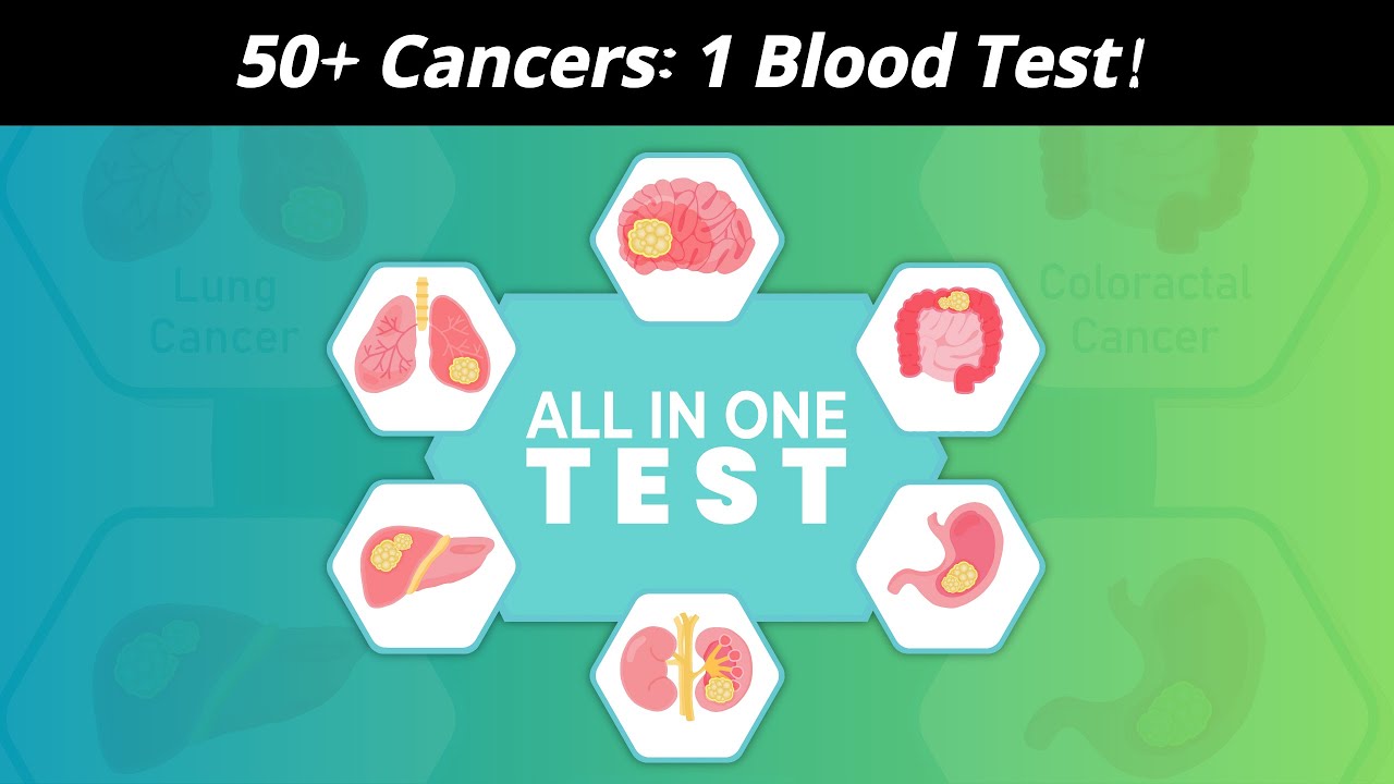 Detect More Than 50 Types of Cancer With Just One Blood Test - Go IT