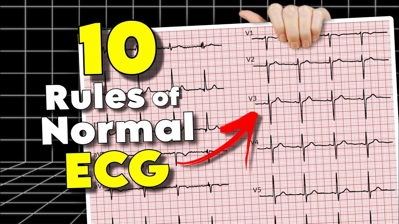 ECG Interpretation: 10 Rules of Normal ECG - YouTube