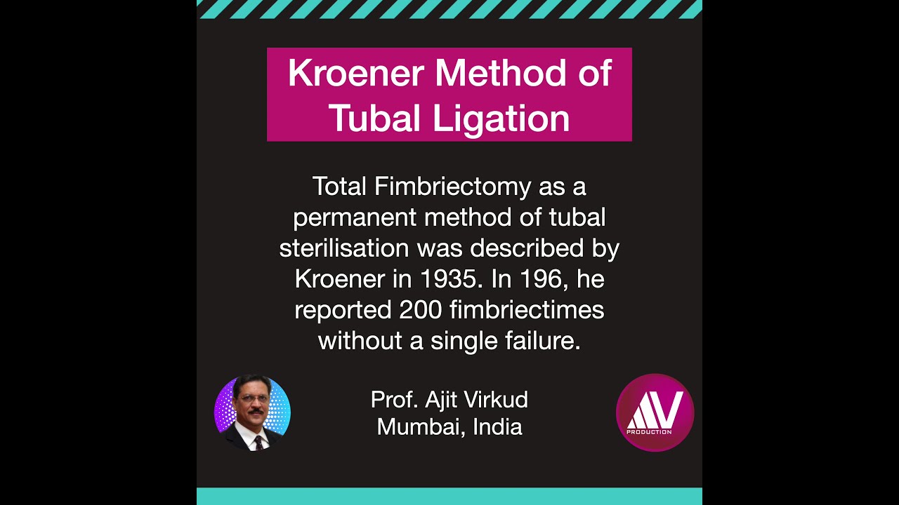 Kroener Fimbriectomy Method of Tubal Ligation - YouTube