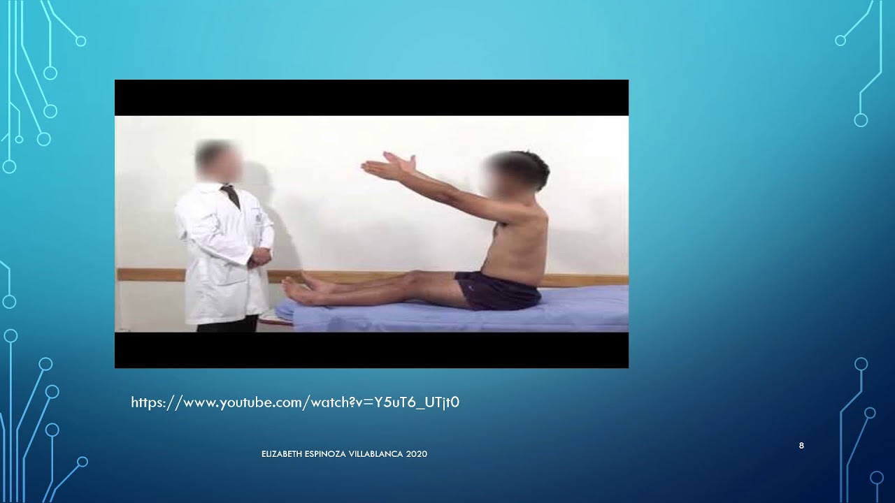 paresia plejia parestesia - YouTube