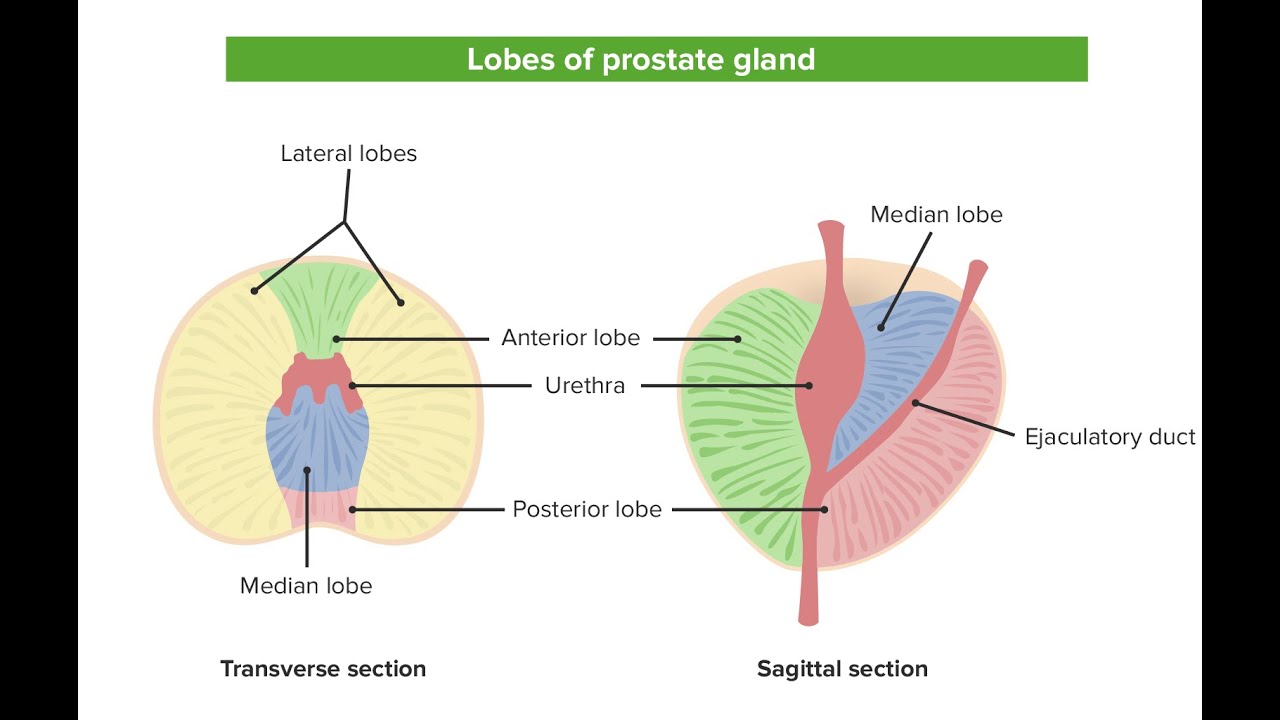 Lobes of the prostate gland; Anterior, posterior, median, right lateral ...