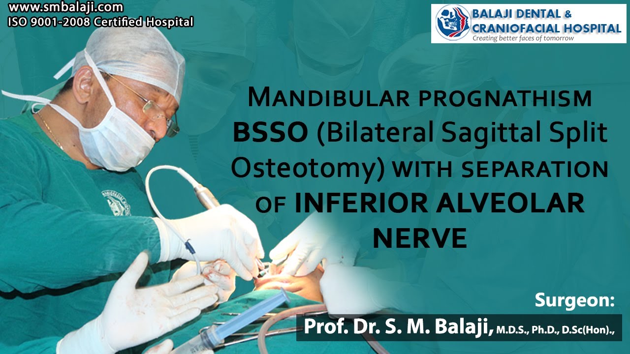 Mandibular Prognathism BSSO (Bilateral Sagittal Split Osteotomy ...