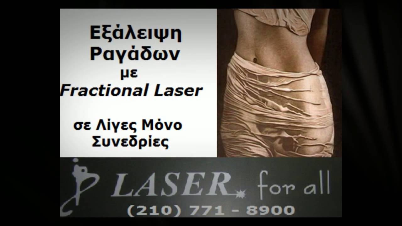 Δερματολόγος Αθήνα | Δερματολόγος Laser - YouTube