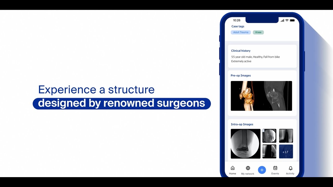 Spotlight on case sharing - YouTube