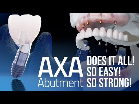 Introducing the AXA Abutment | A New Solution for All-on-X