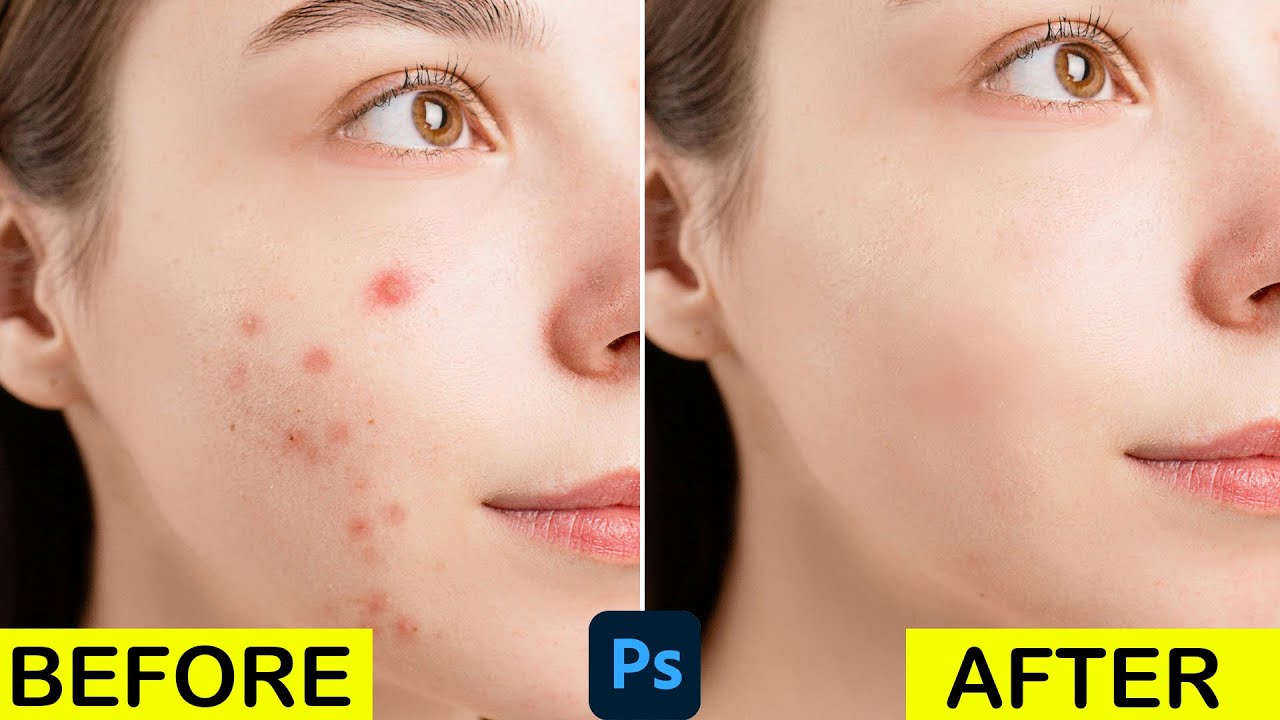 Face Retouching in Photoshop Made Easy || Step by Step Photoshop ...