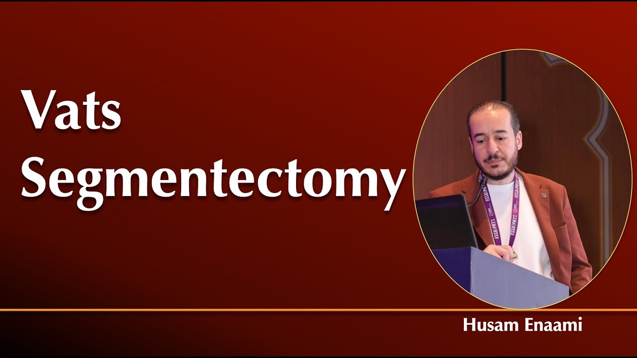 VATS, Segmentectomy - YouTube