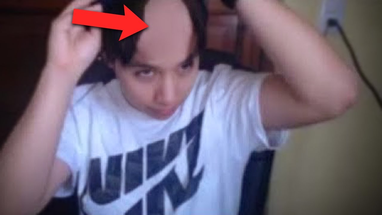 Quackity's Hairline - YouTube