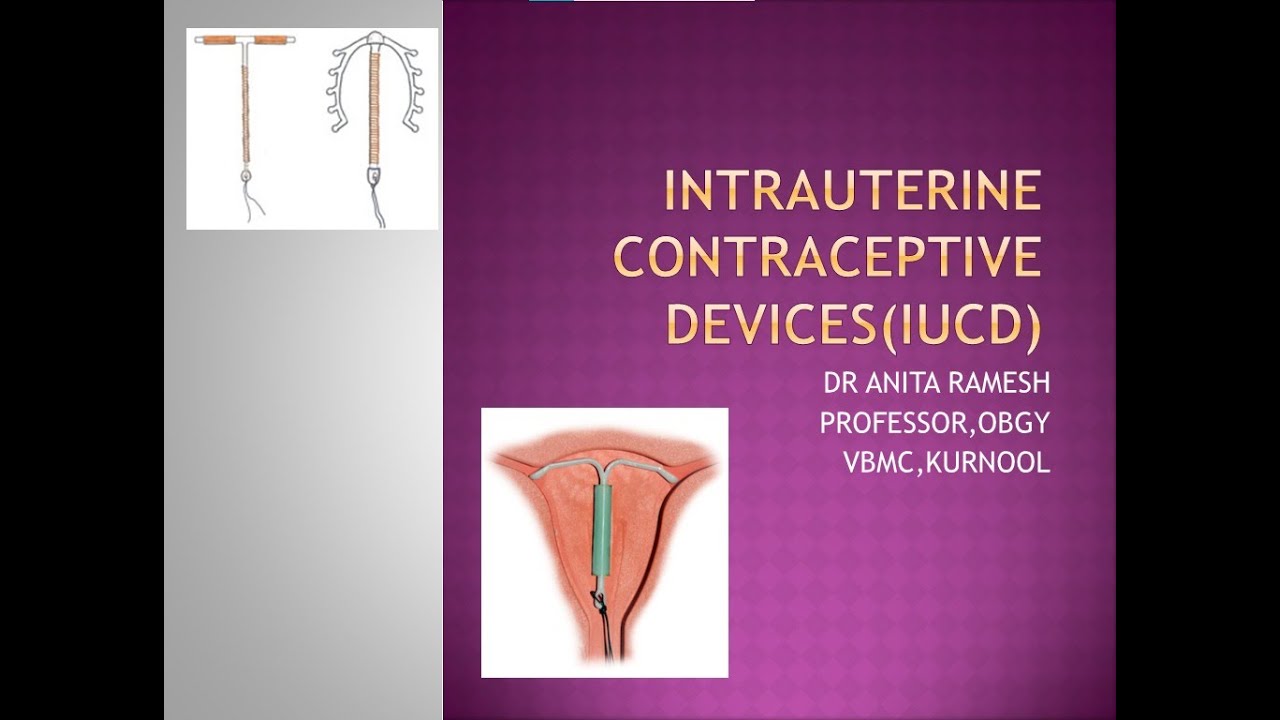 OBGY MADE EASY....IUCDs...Intrauterine Contraceptive Devices Lecture ...