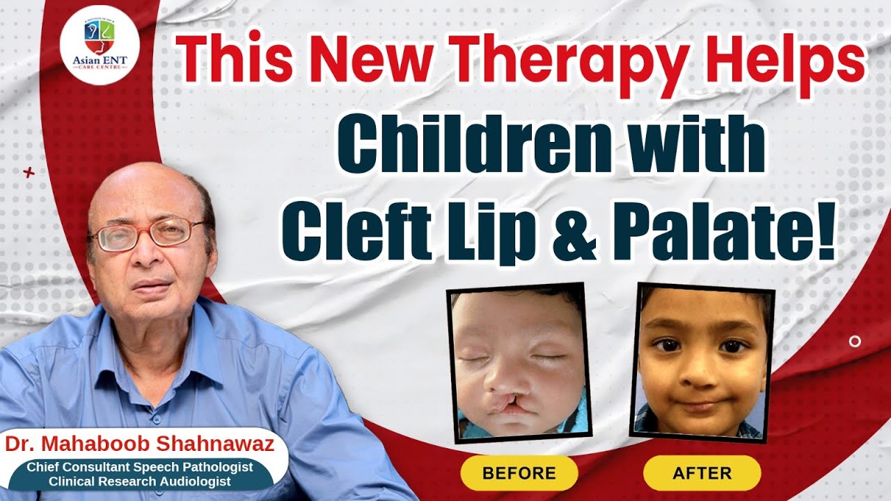 How To Treat Cleft Lip And Palate In Children | New Voice Recovery ...