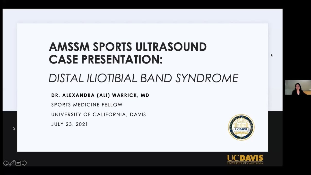 Distal Iliotibial Band Syndrome with Dr. Ali Warrick | AMSSM Sports ...
