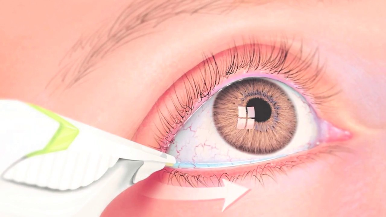 TearLab - How to Test - YouTube