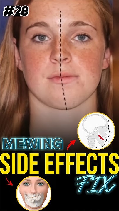 Mewing Side Effects Fix - YouTube