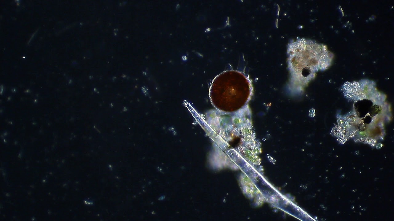Arcella sp. (Testate amoeba) - Protozoans and other small critters ...