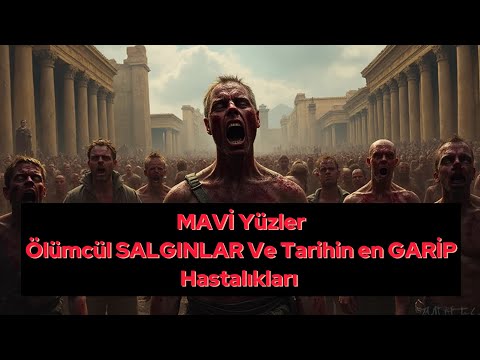 “MAVİ YÜZLER !TARİHİN EN GARİP VE GİZEMLİ HASTALIKLARI 😨”#history #azbilinengerçekler #bilgi #tarih 