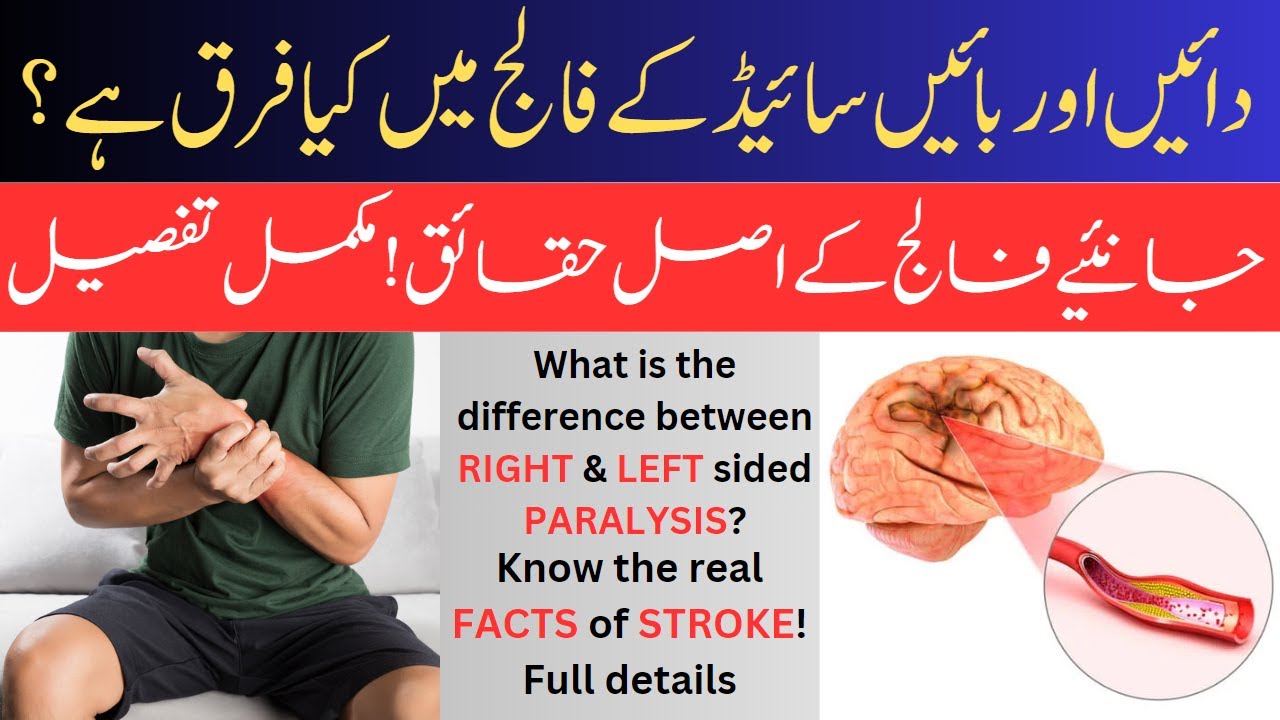 Left & Right Side Paralysis | Brain Stroke | Symptoms - YouTube