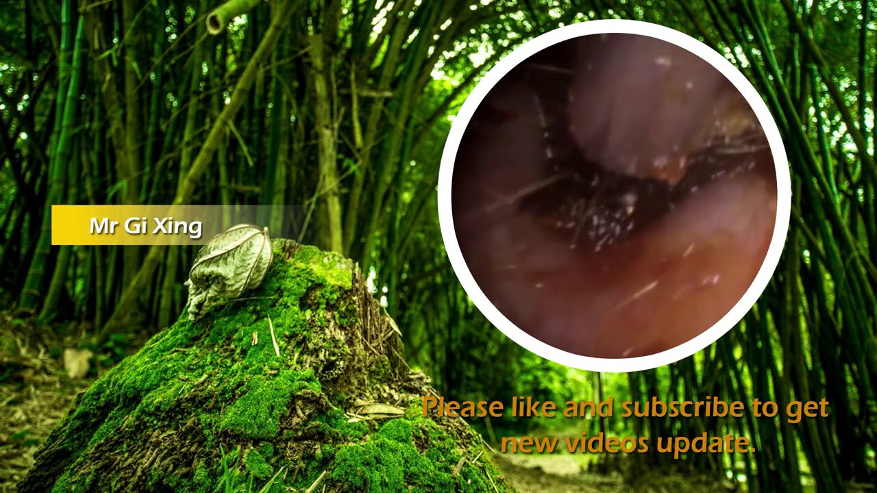 Best Cleaning Ear With Natural Background and relaxing music - YouTube