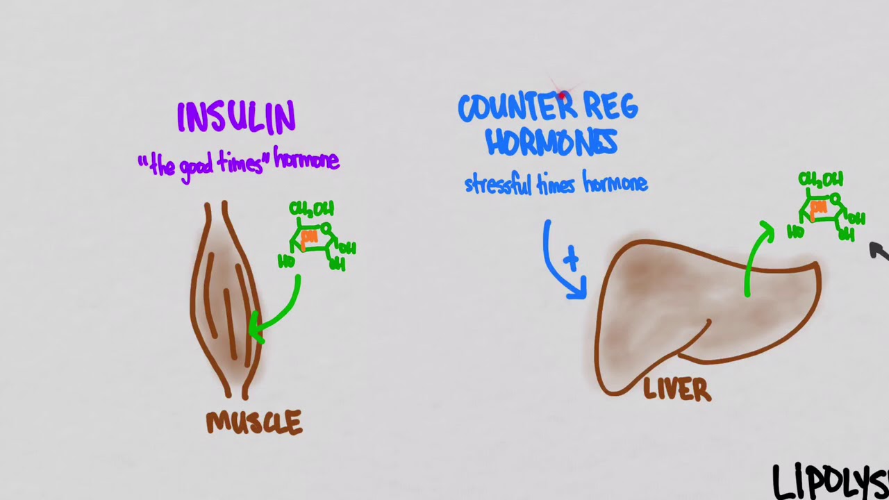 Pediatric DKA (Part 2) - Diabetes