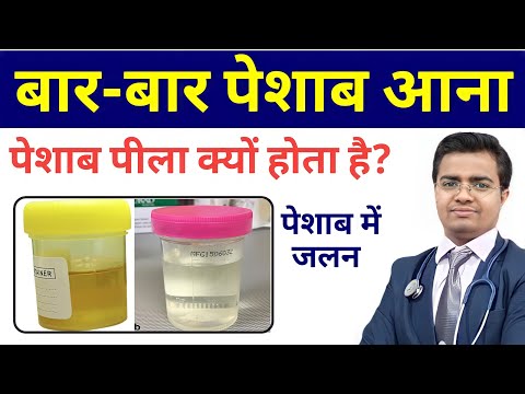 बार बार पेशाब आना | पेशाब में जलन | बार बार पेशाब आने के कारण और इलाज | bar bar peshab ana ki waja