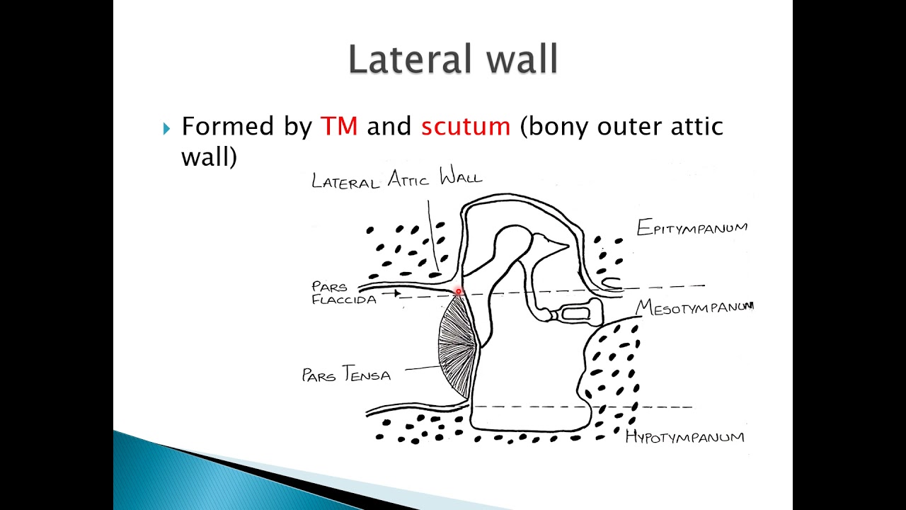 Attic Middle Ear Diagram