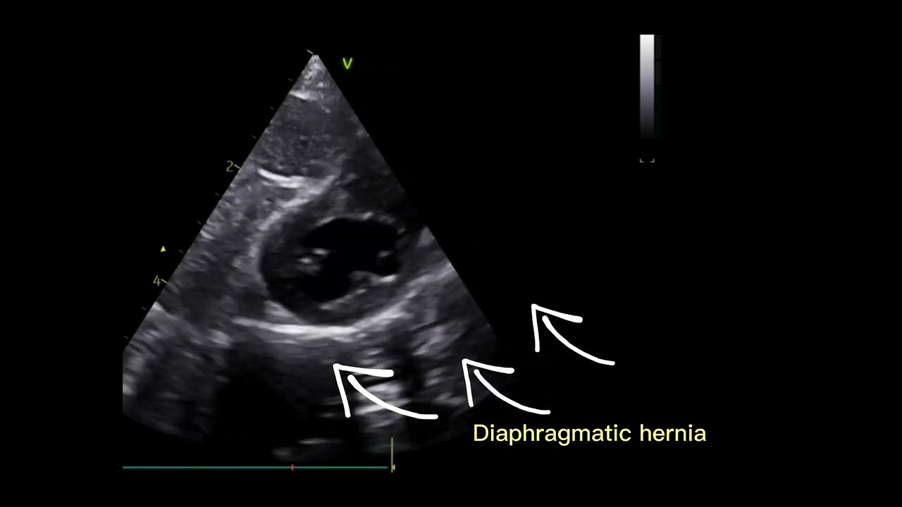 Peritoneopericardial diaphragmatic hernia in a 3 month-old kitten 🐱😵 ...
