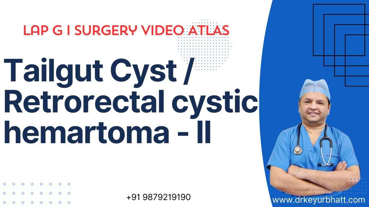 Tail Gut Cyst part 2 | Duplication cyst | How to do tailgut cyst ...