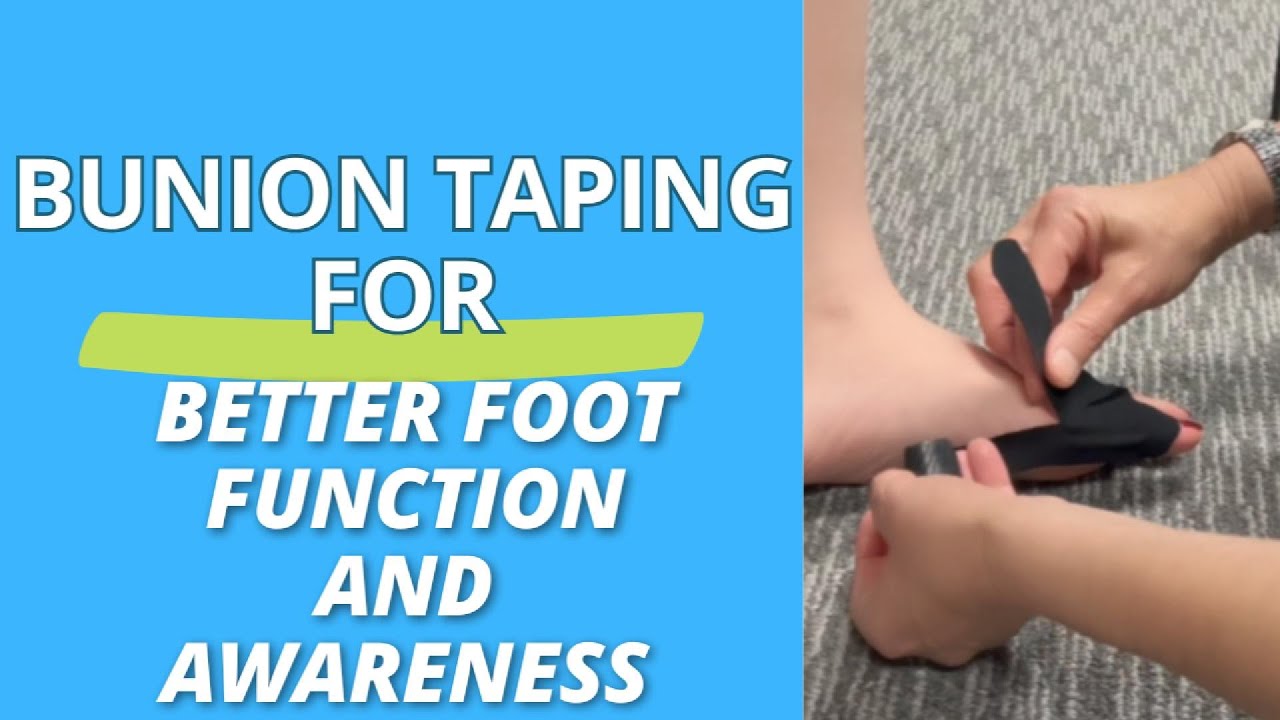 Bunion Taping for Better Foot Function and Awareness #bunioncorrector #bunionrelief #footpain ...