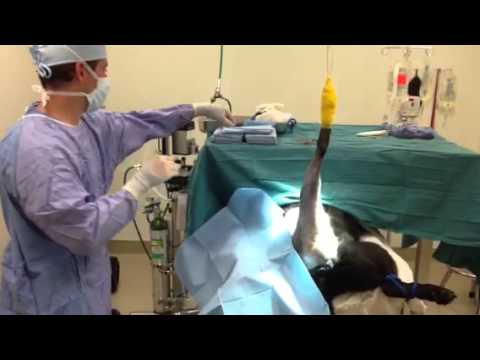 NVS Surgery - drape in a hanging leg - YouTube