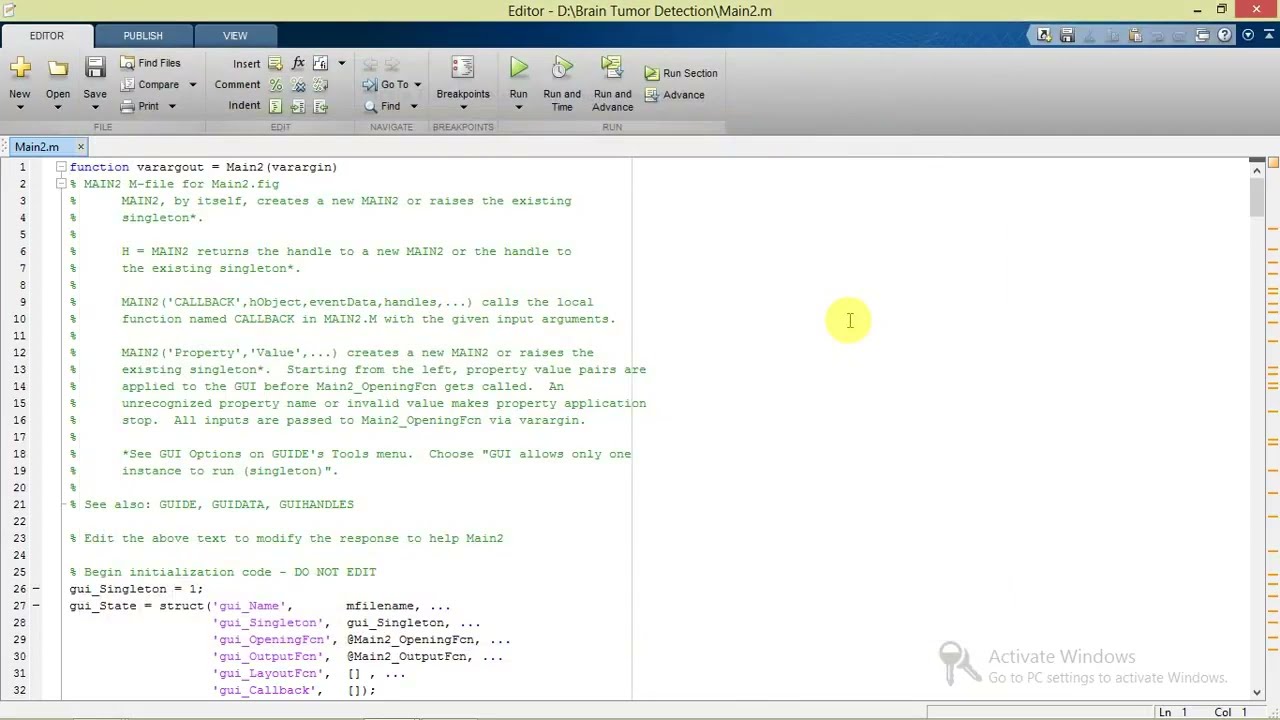 Brain Tumor Detection Using Image Processing Matlab Project with Source ...