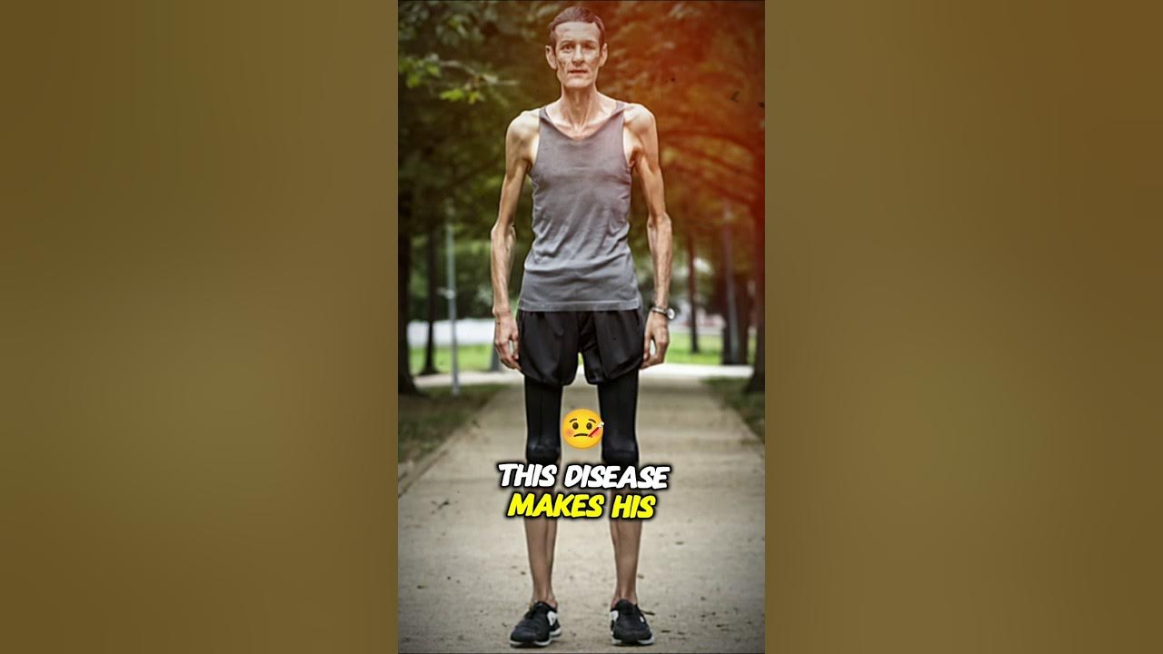 Worlds Thinnest Man🕴#qgiftehar #facts #shorts - YouTube