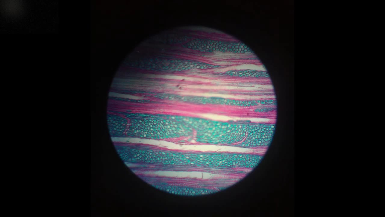 T S of Ephedra Stem - YouTube