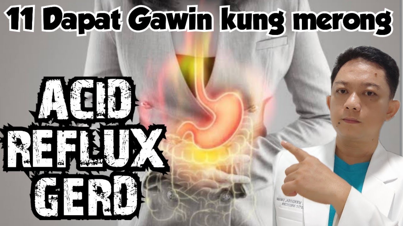 11 NATURAL REMEDIES SA ACIDITY PROBLEM, ACID REFLUX, GERD - YouTube