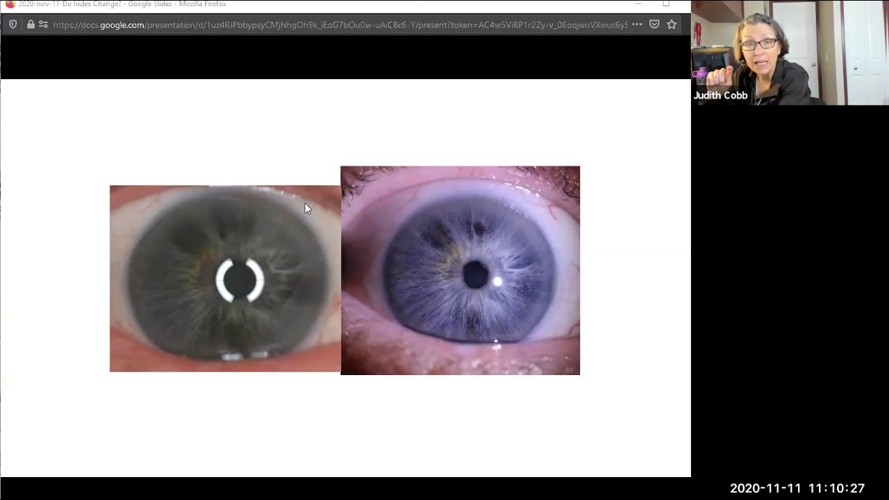 IRIDOLOGY: How Irides Change - YouTube