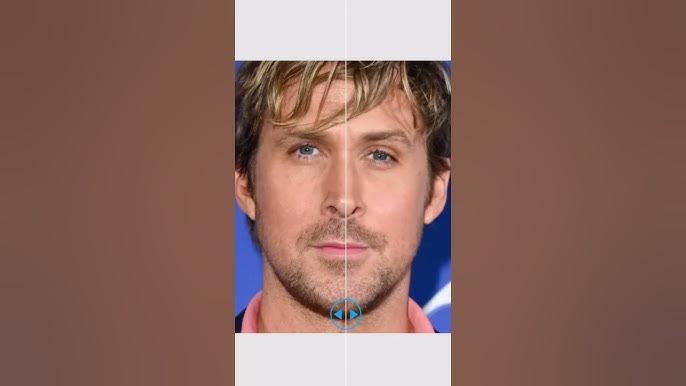 Ryan Gosling, Schielendes Auge