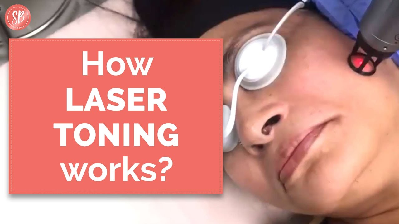 Laser Skin Toning Treatment | Pigmentation | Laser Toning Treatment in ...