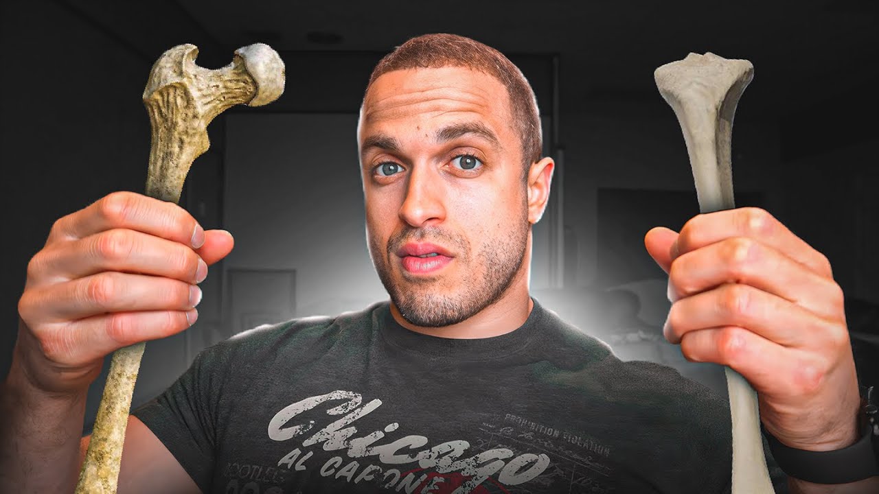 Femur vs. Tibia - which is better for Limb Lengthening surgery - YouTube