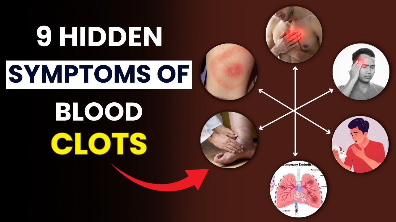 9 Hidden Symptoms of Blood Clots That Can Kill Suddenly You Ignore ...