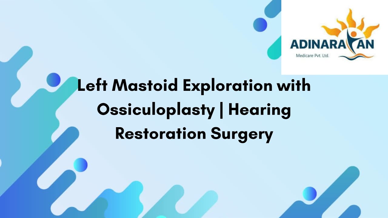 Left Mastoid Exploration with Ossiculoplasty Hearing Restoration ...