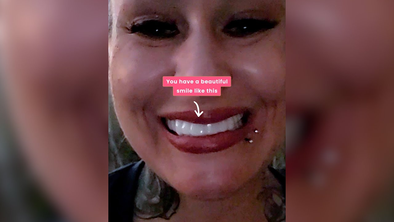 No more smile insecurity🤩 - YouTube