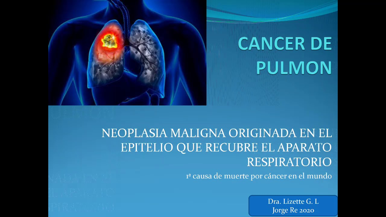 Cancer Pulmonar - YouTube