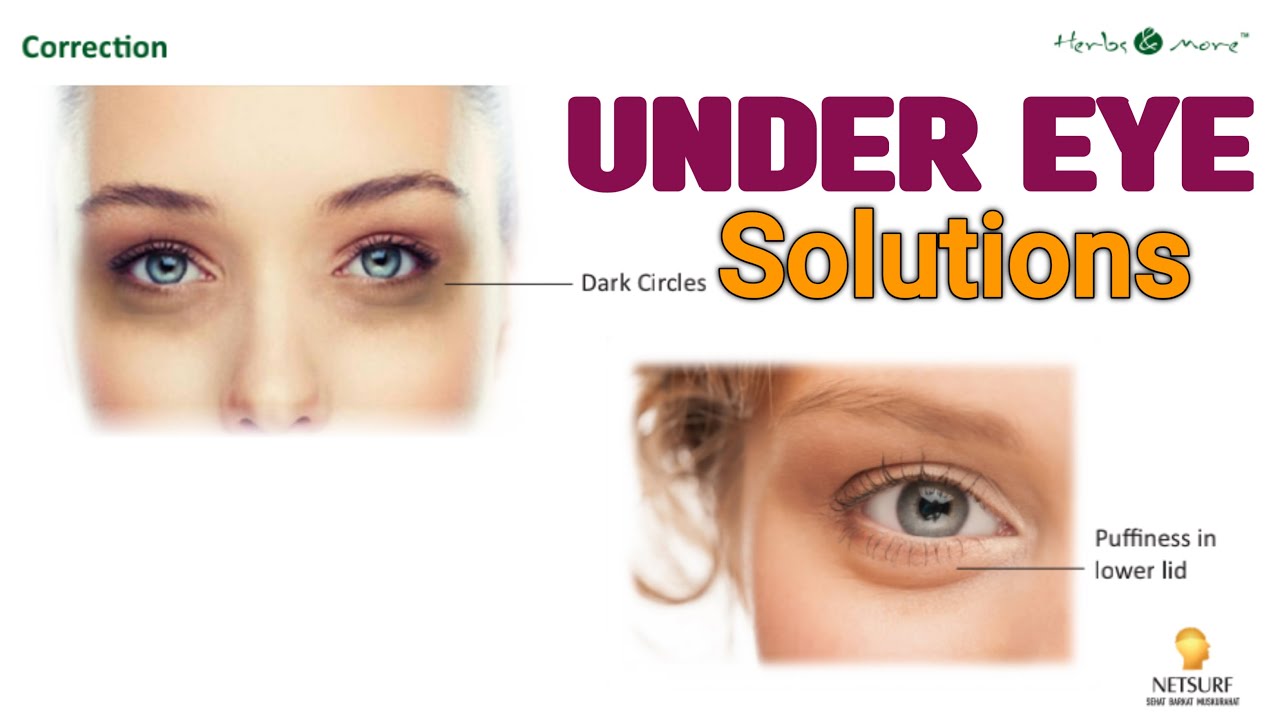 UNDER EYE Solutions : Netsurf Products Live Training | आँखों के नीचे के ...