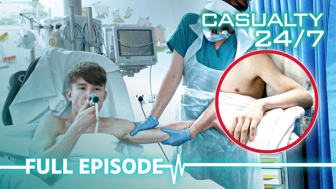 Doctors Reset Dislocated Arm | Casualty 24/7 - S04 E10 (Full Episode ...