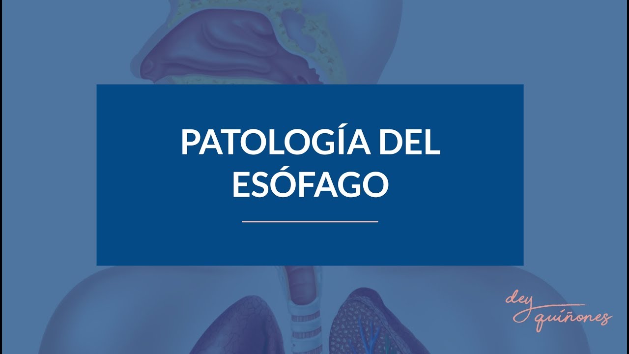 Patología del esófago - YouTube